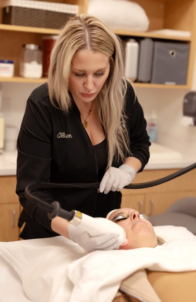LaseMD Non-Ablative Laser in Colgate, WI
