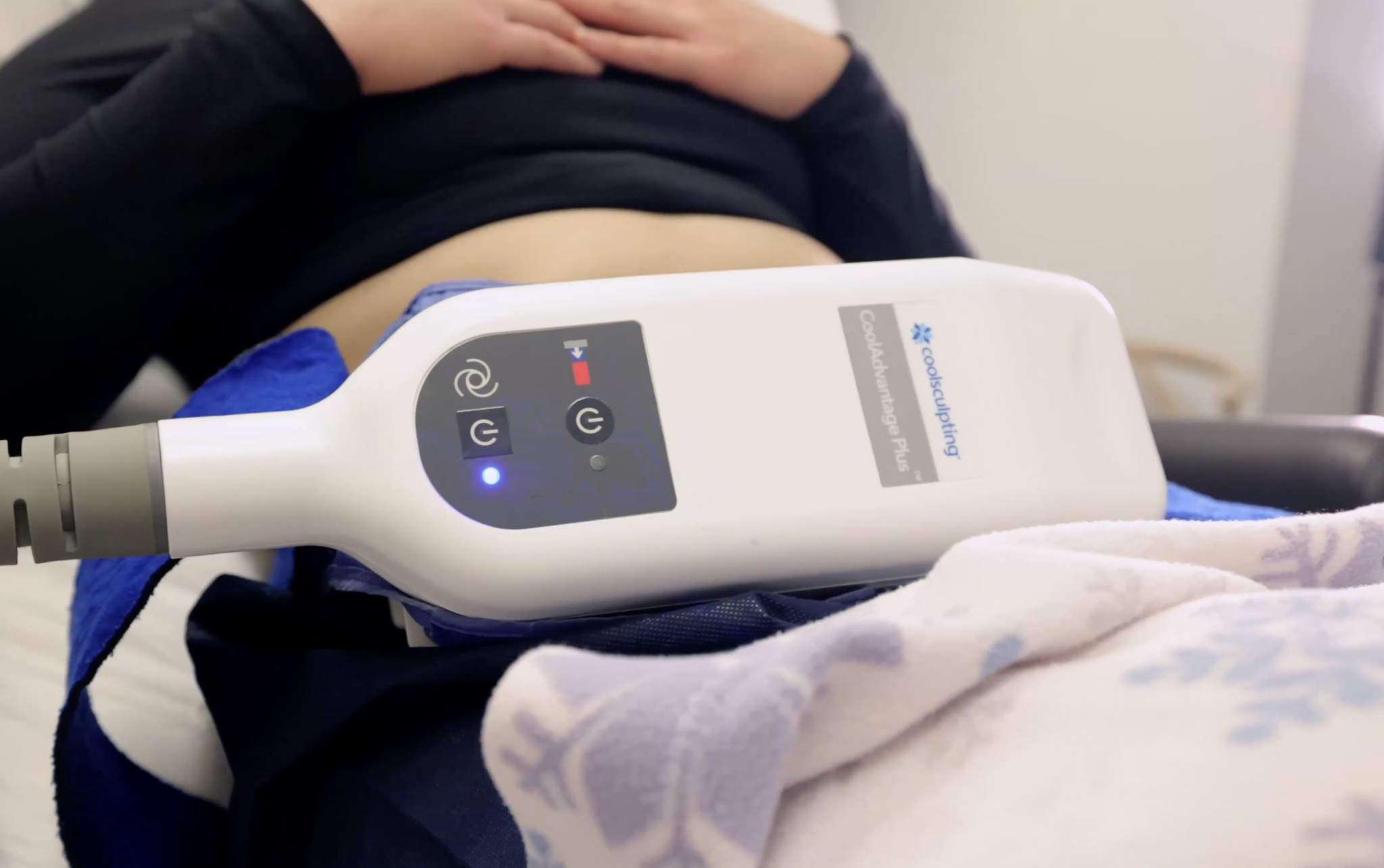 CoolSculpting in Colgate, WI